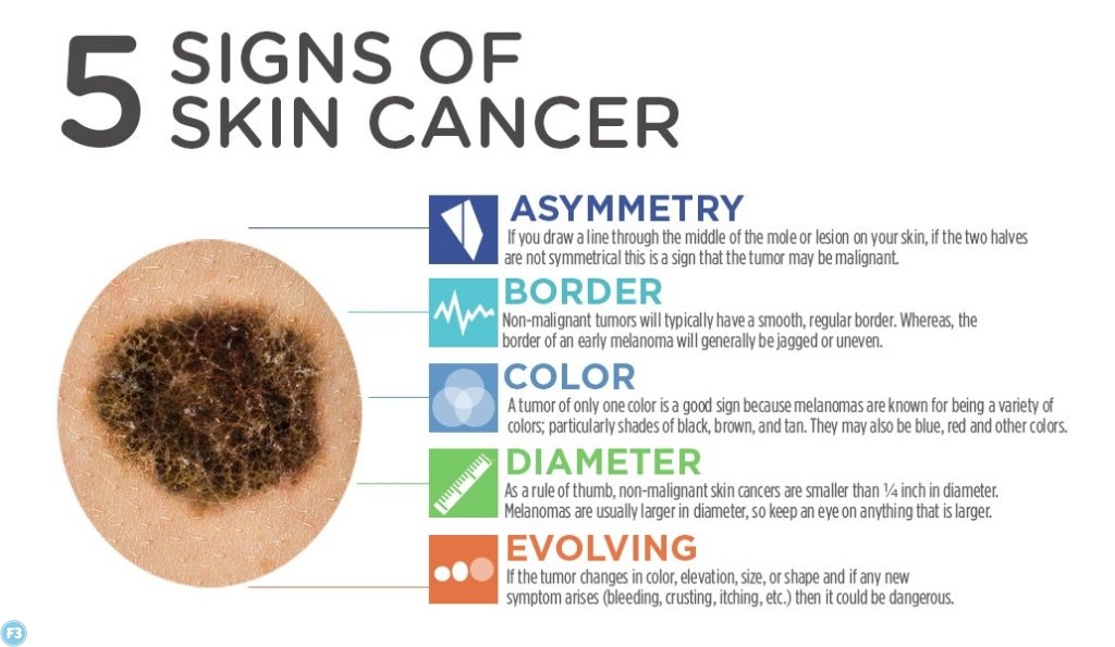 Skin cancer - स्किन कैंसर से बचने के लिए उपाय और संकेत