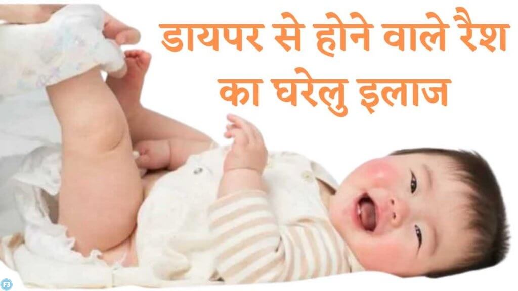 Diaper Rashes – डायपर से होने वाले रैश का आयुर्वेदिक और घरेलु इलाज
