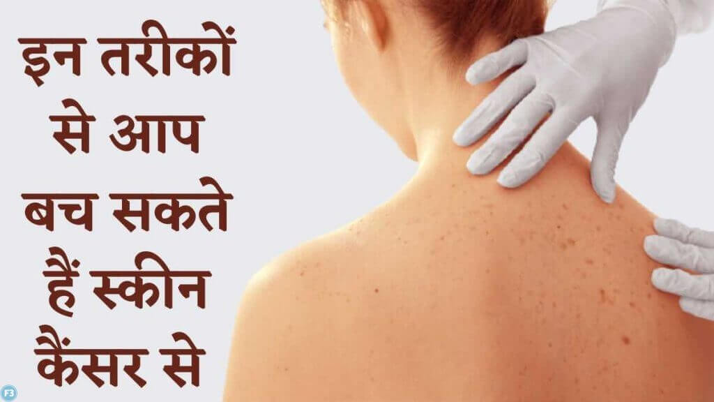 Skin cancer - स्किन कैंसर से बचने के लिए उपाय और संकेत